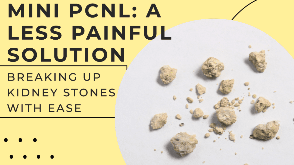 Does Drinking More Water Prevent Kidney Stones? | Expert Insights