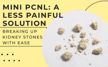 Mini PCNL: Less Painful Solution for Kidney Stones