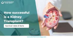 How Successful is a Kidney Transplant? Survival Rates & Key Facts