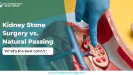 Does Drinking More Water Prevent Kidney Stones? | Expert Insights