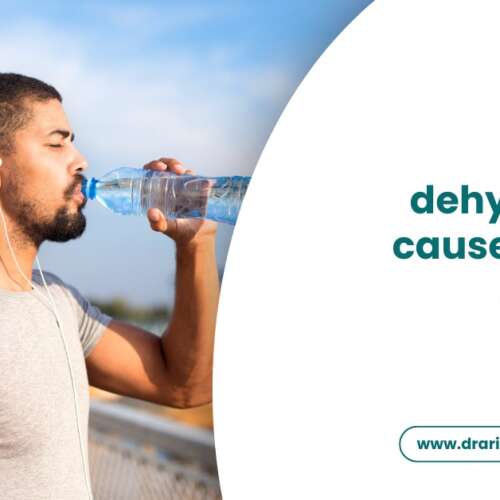 Does Drinking More Water Prevent Kidney Stones? | Expert Insights